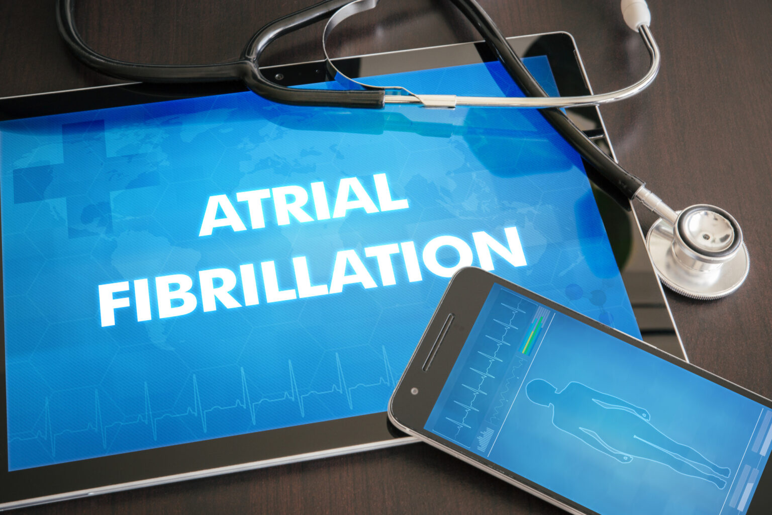 The Most Common Signs and Symptoms of Atrial Fibrillation - Pick-Kart .com